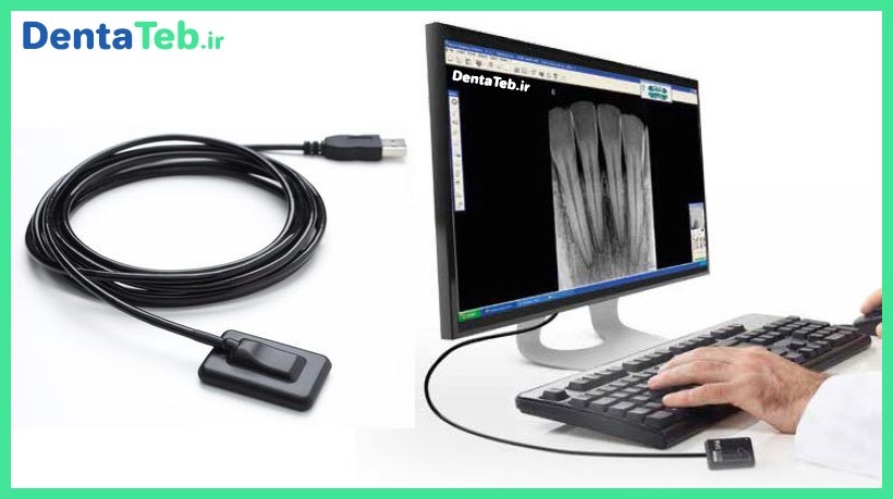 سنسور Rvg - خرید و قیمت ار وی جی دندانپزشکی | دنتاطب